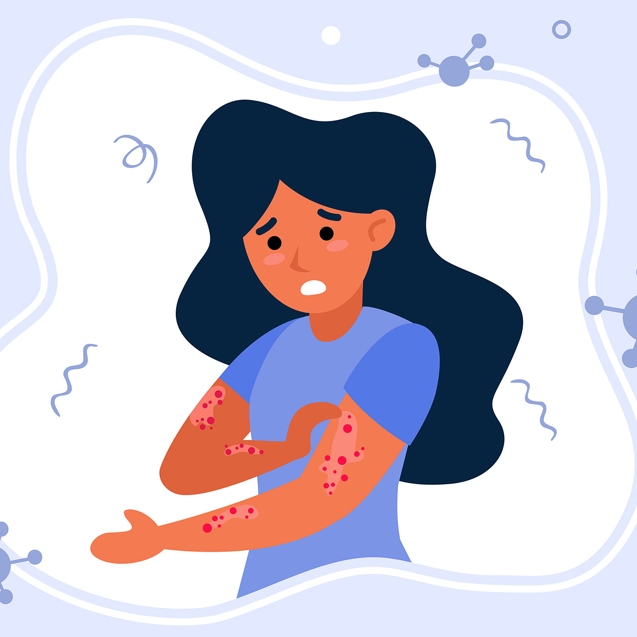 Psoriasis Treatment Products for Skin Relief