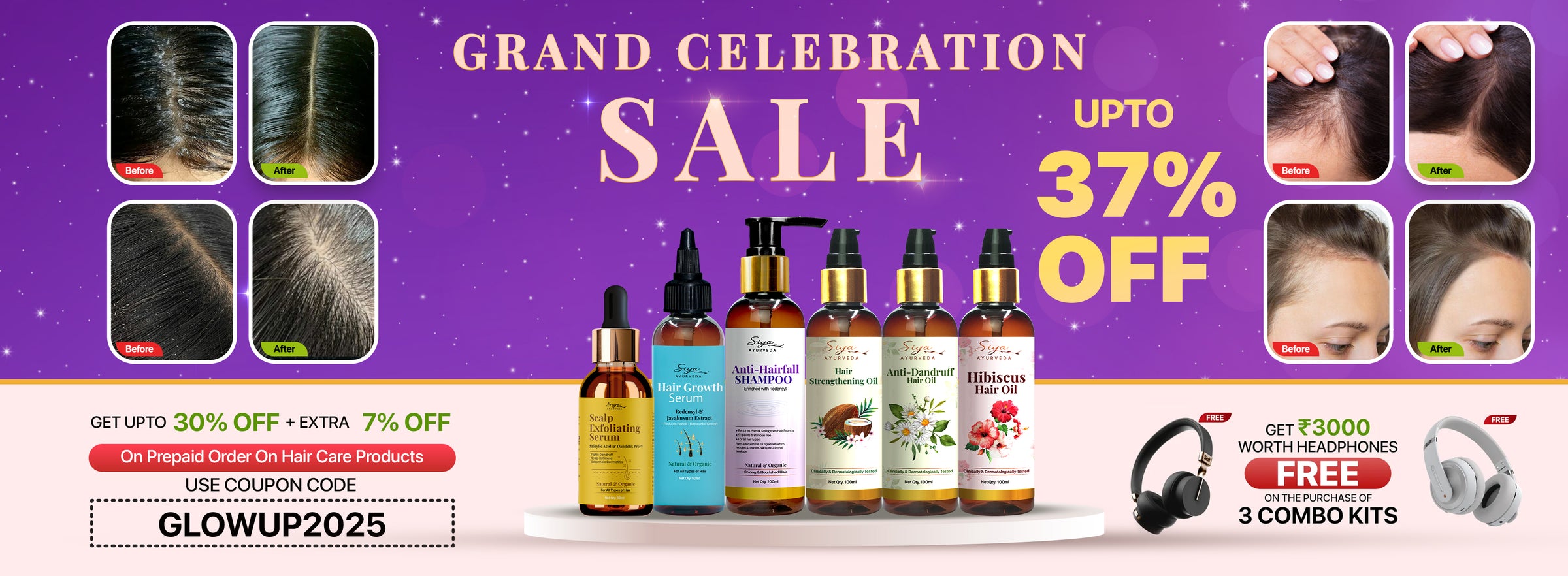 Best Hair Care Kit for Scalp Treatment & Hair Growth