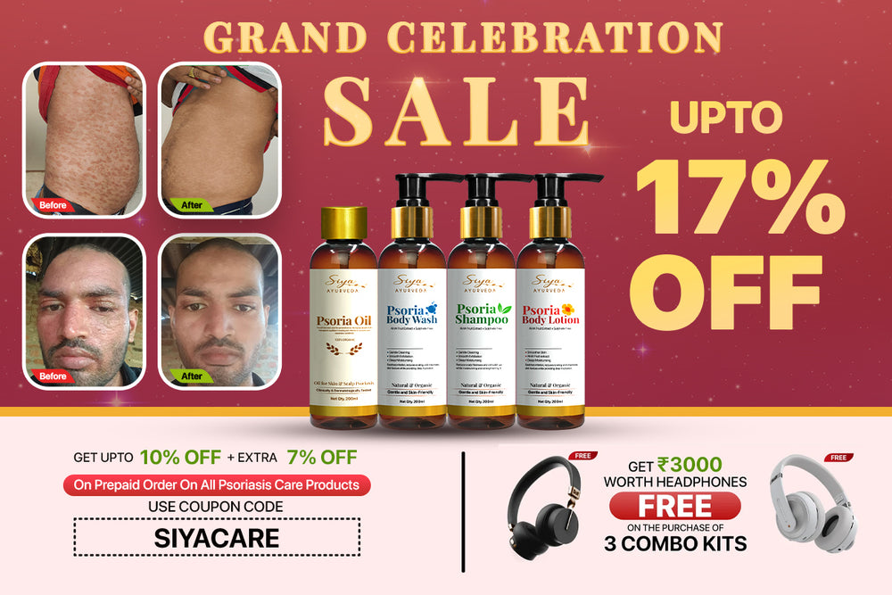 Psoriasis Treatment Products for Skin Relief